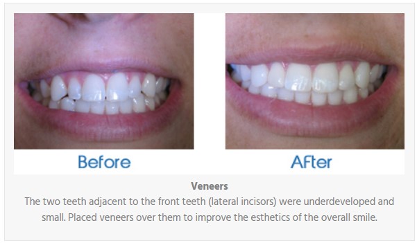 Smile Gallery - Center for Oral Health